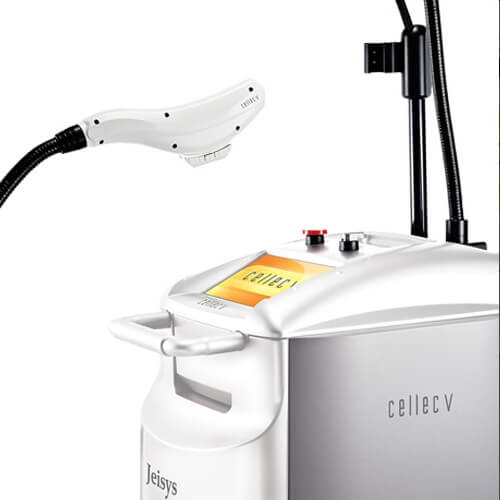 Cellec V – Hệ thống IPL chuyên điều trị mạch máu – Dermamed